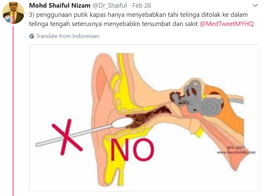 ''Tahi Telinga Keluar Secara Semulajadi Bila Menguap Atau Mengunyah ...