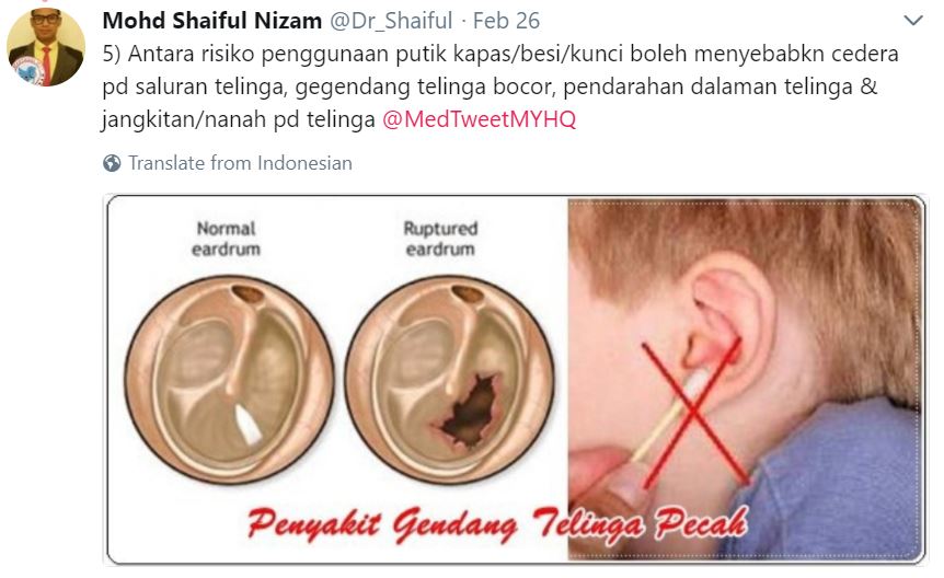 ''Tahi Telinga Keluar Secara Semulajadi Bila Menguap Atau Mengunyah ...